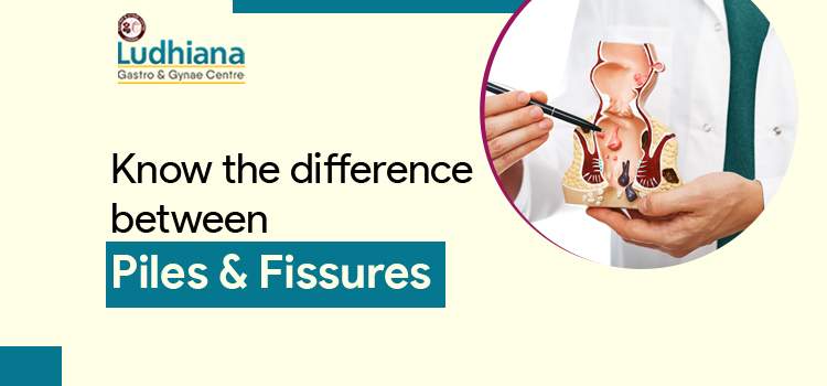 Piles and Fissures Treatment in Ludhiana, Punjab